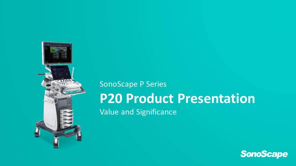 Sonoscape P20 công nghệ 5D/S-live real time